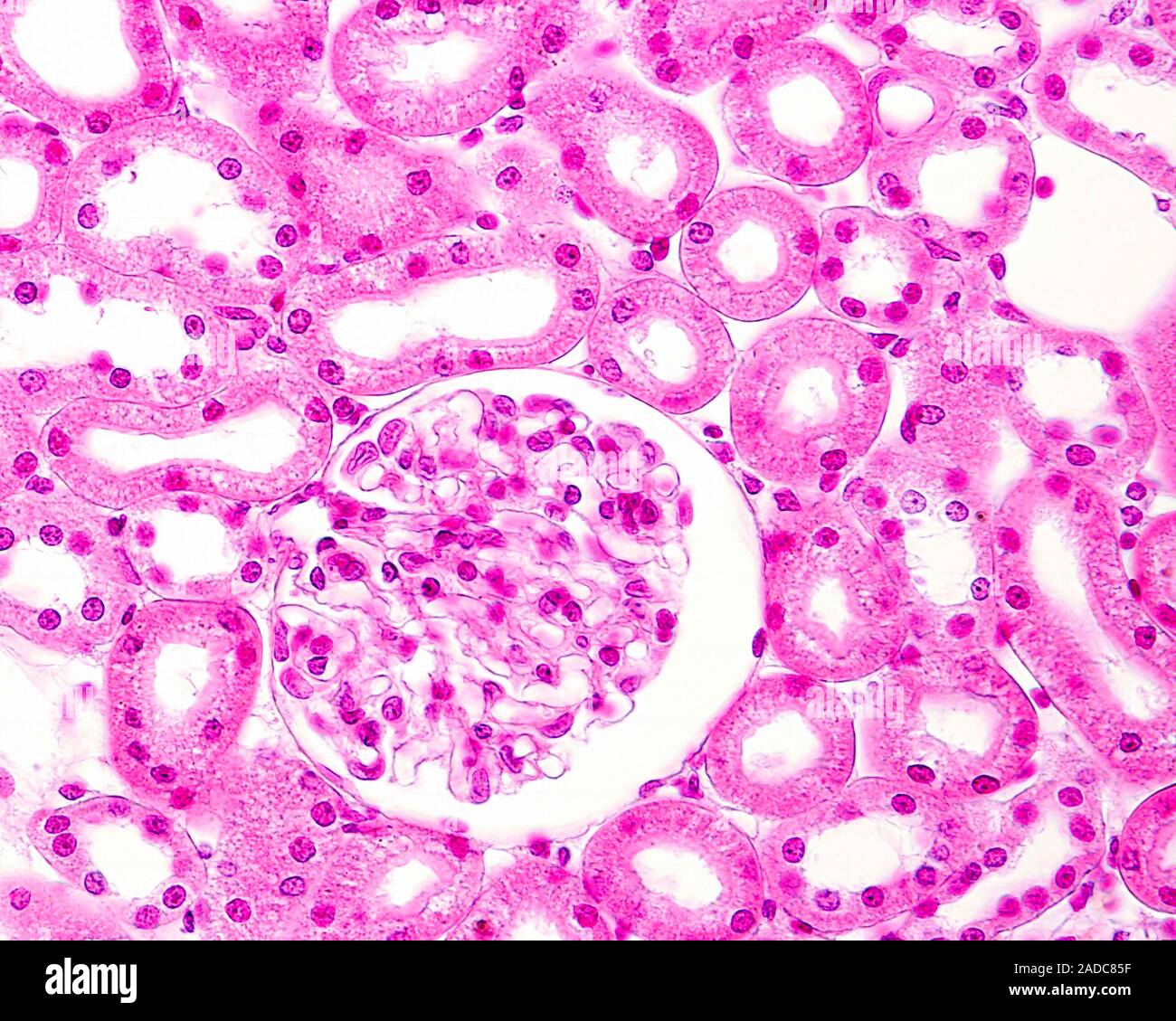 Light micrograph of the renal cortex of a kidney that has been fixed by ...