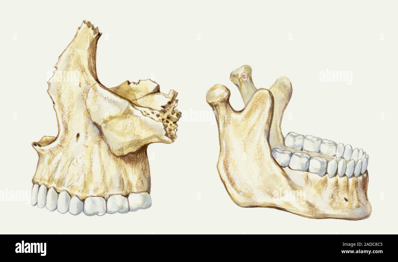 Upper and lower jaw bones, illustration Stock Photo - Alamy