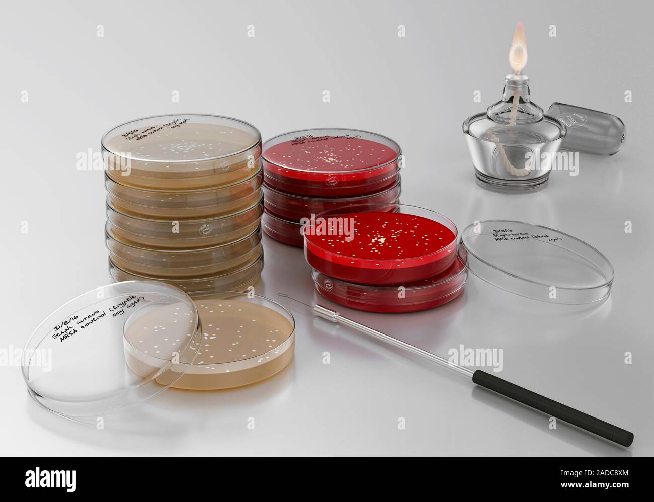 A laboratory scene depicting control samples of methicillin-resistant ...