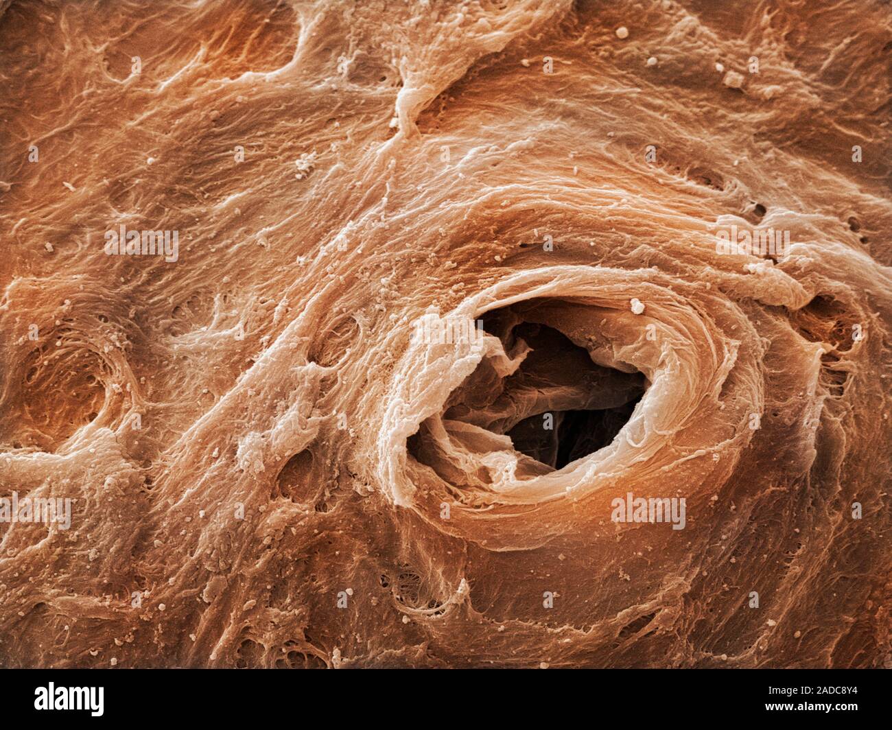 Human sweat pore. Coloured scanning electron micrograph (SEM) of a ...