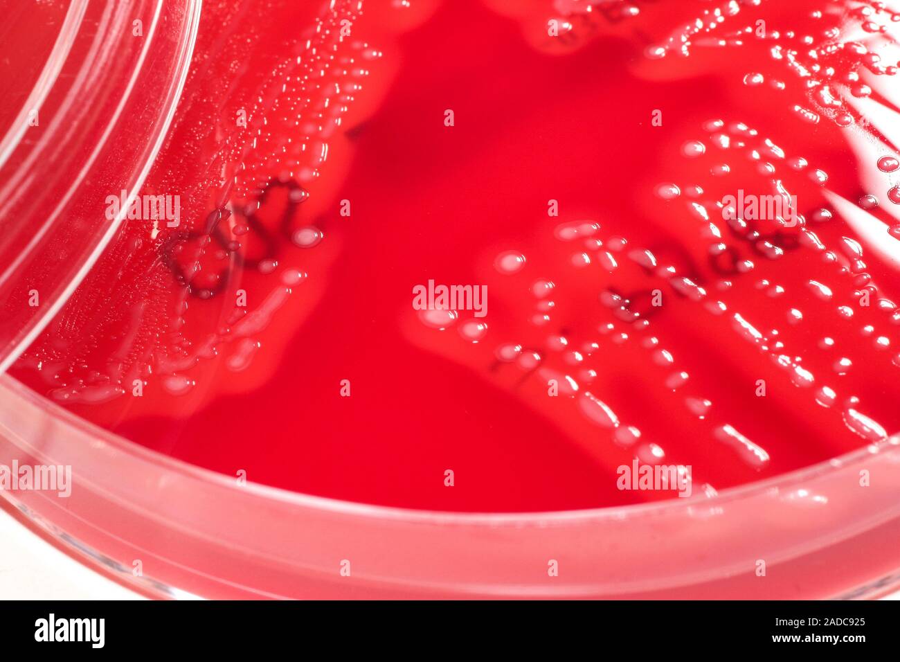 Streptococcus pyogenes culture. Petri dish containing a nutrient medium ...