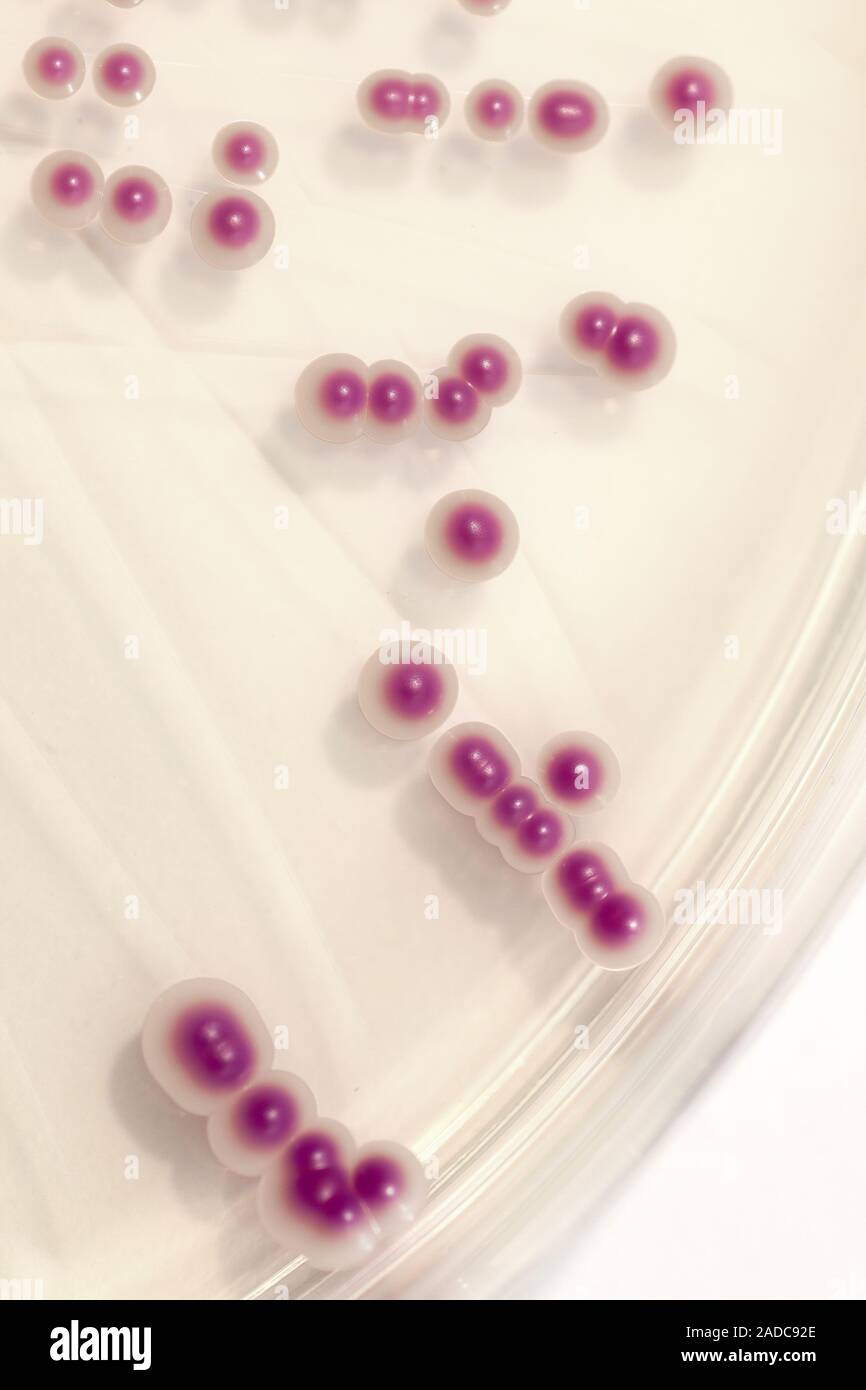 Candida glabrata fungal culture. Close-up of a petri dish culture of ...