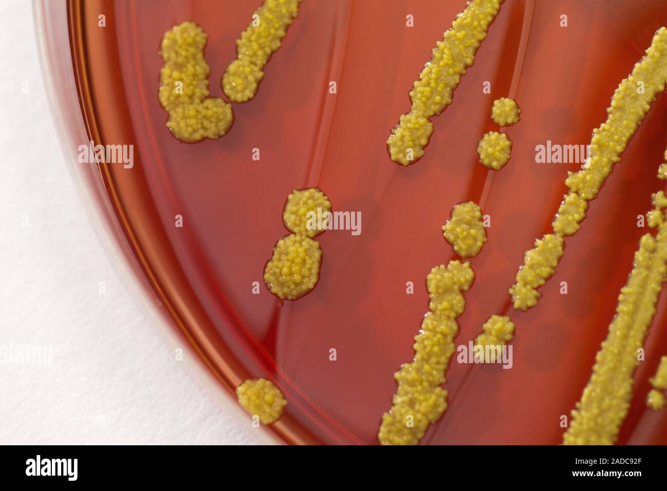 Micrococcus bacterial culture. Petri dish containing a nutrient medium ...