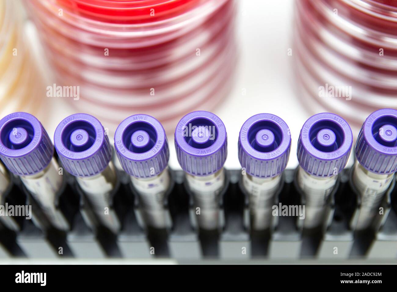 Microbial sample transport swabs. These standard containers are used to ...