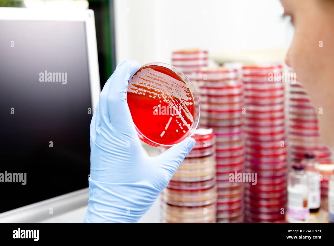 Microbiologist examining an agar plate. Microbiologist holding a petri ...