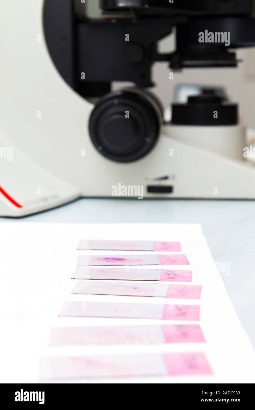 Bacterial slides. Row of stained glass slides in a laboratory, with a ...