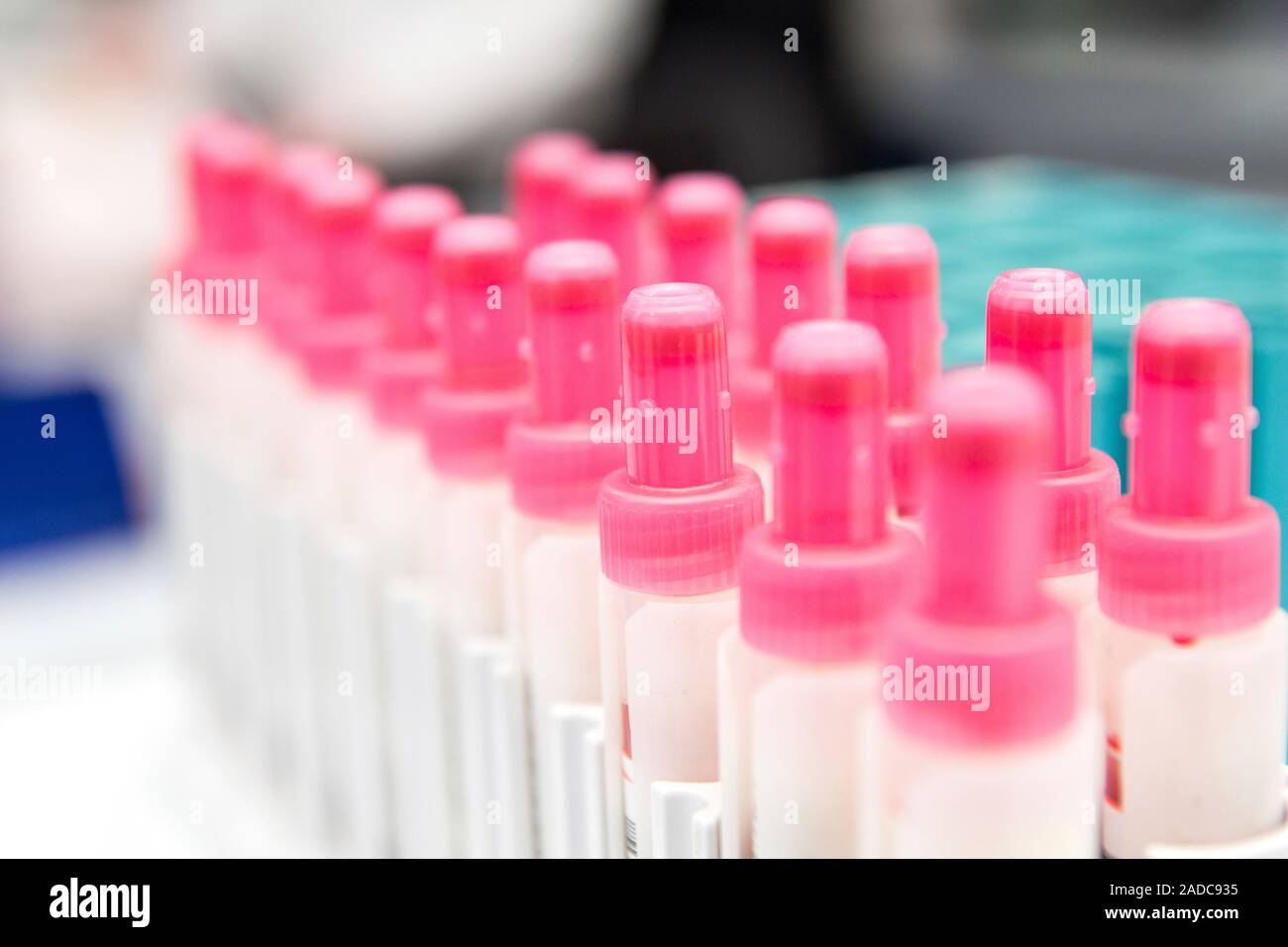 Microbial sample transport swabs. These standard containers are used to ...