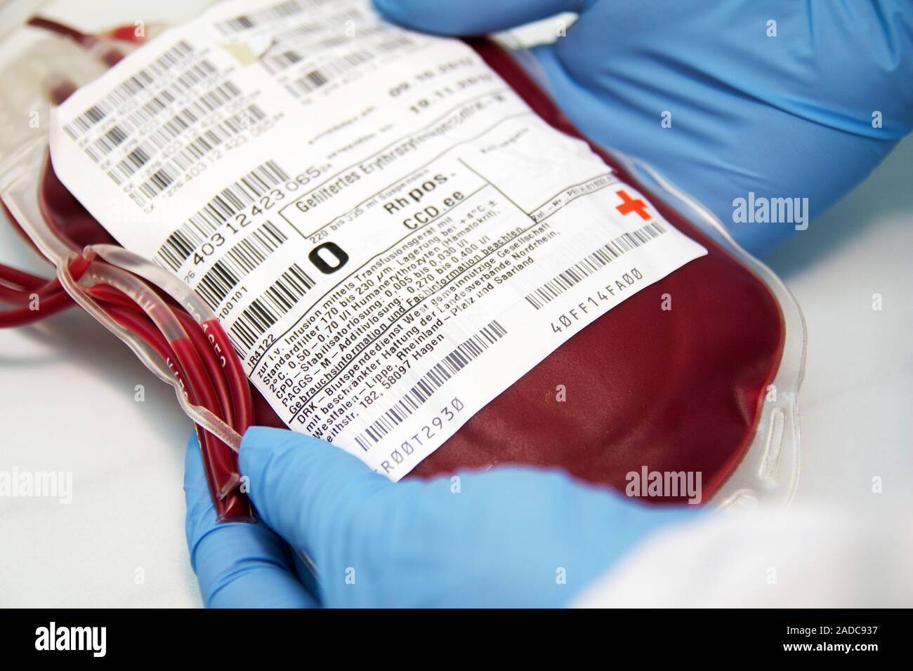 Donor blood analysis. Haematologist handling a blood bag in a medical ...