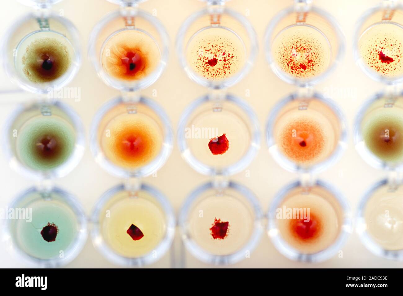 Blood group test showing reactions between blood types and antibody ...