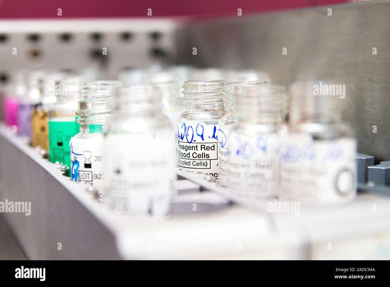Blood sample analysis. Blood samples being analysed in a medical ...