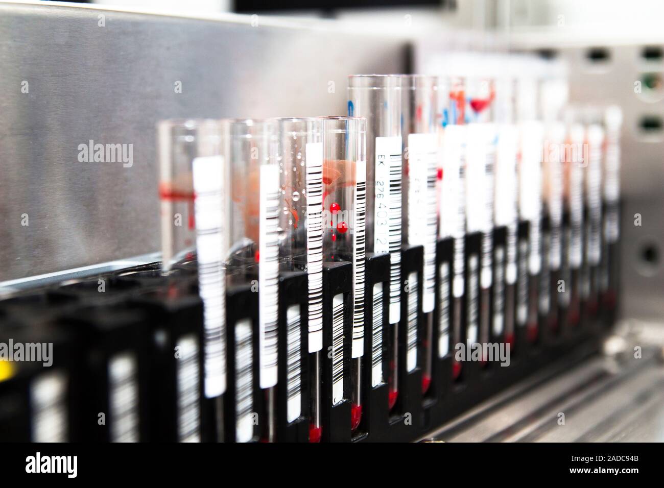 Blood sample analysis. Blood samples being analysed in a medical ...