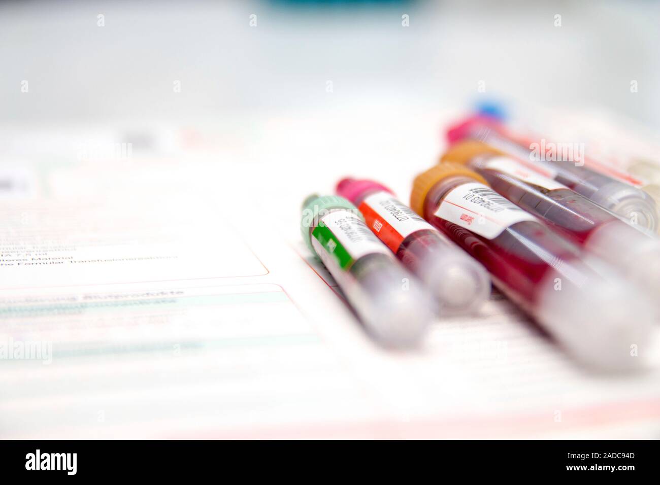 Blood sample analysis. Blood samples being analysed in a medical ...