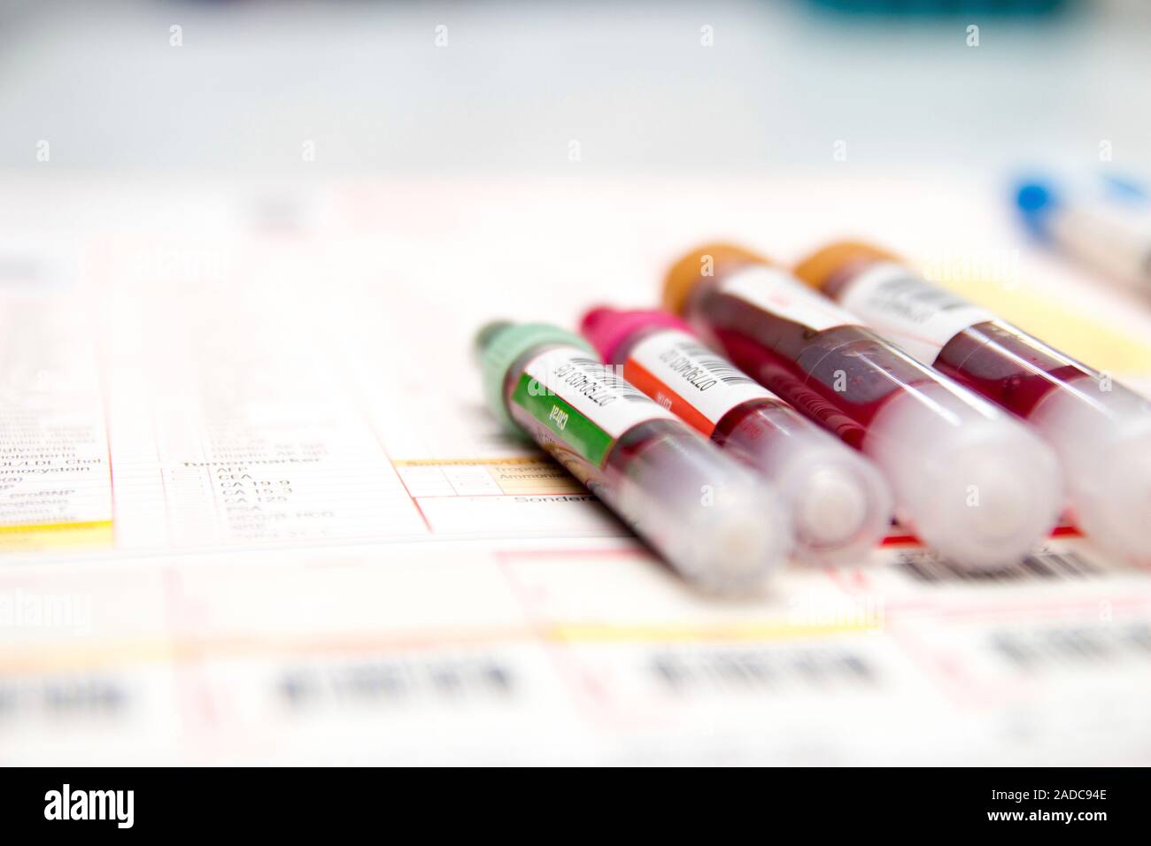 Blood sample analysis. Blood samples being analysed in a medical ...