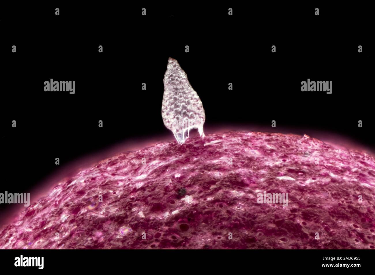 Radiolarian on a matchstick. Macrophotograph of a single shell of a ...