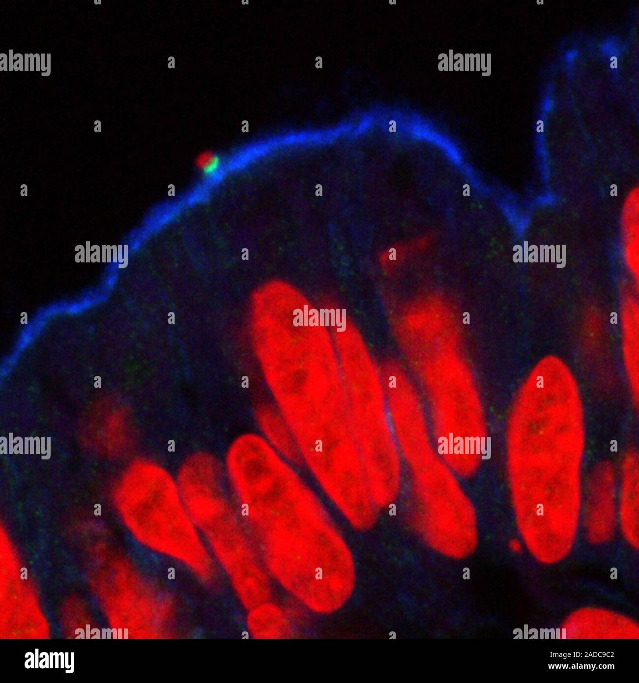 E. coli bacterium in small intestine. Fluorescence light micrograph of ...