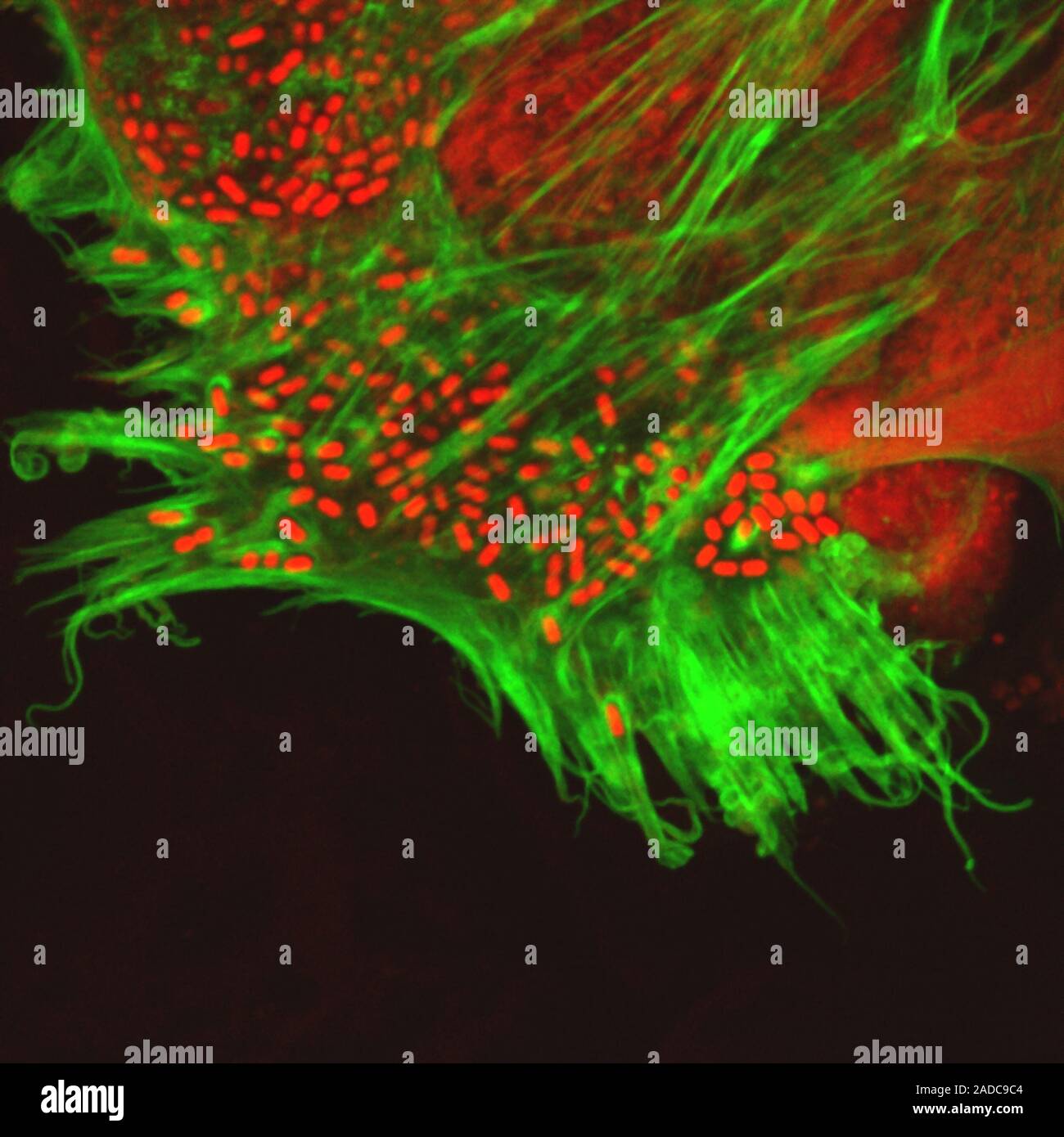 Shigella bacteria on intestinal tissue. Fluorescence light micrograph ...
