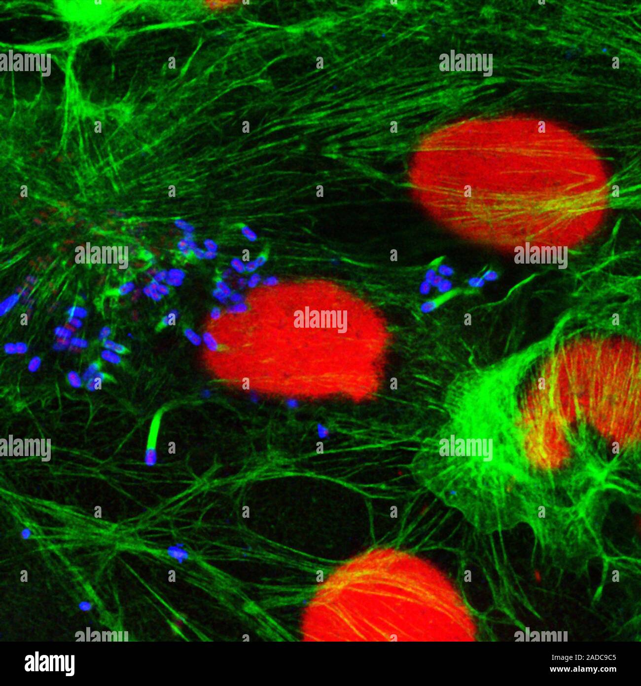 Shigella bacteria on intestinal tissue. Fluorescence light micrograph ...