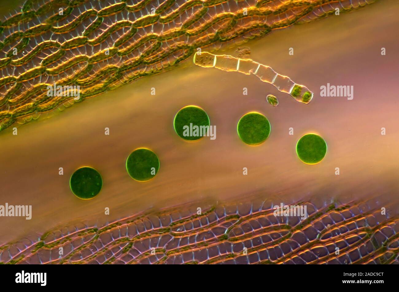 Green algae. Polarised darkfield light micrograph of green algae (green ...