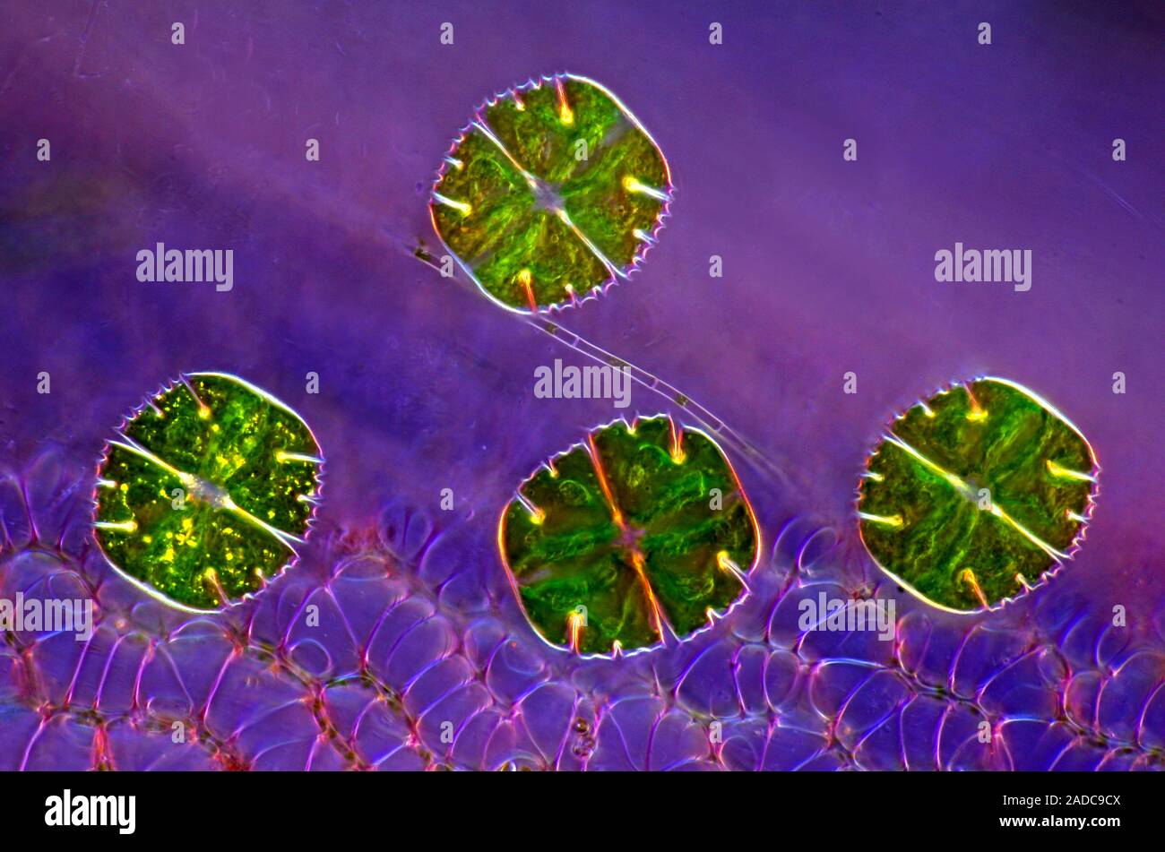 Micrasterias truncata algae. Polarised darkfield light micrograph of ...