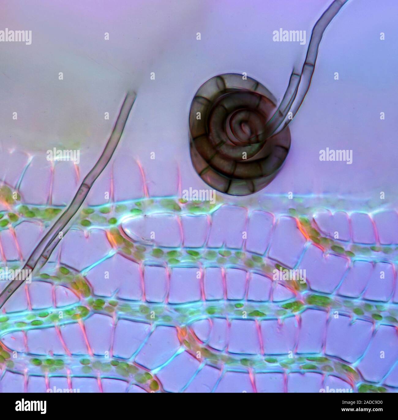 Fungal hyphae. Polarized light micrograph of the hyphae (brown threads ...