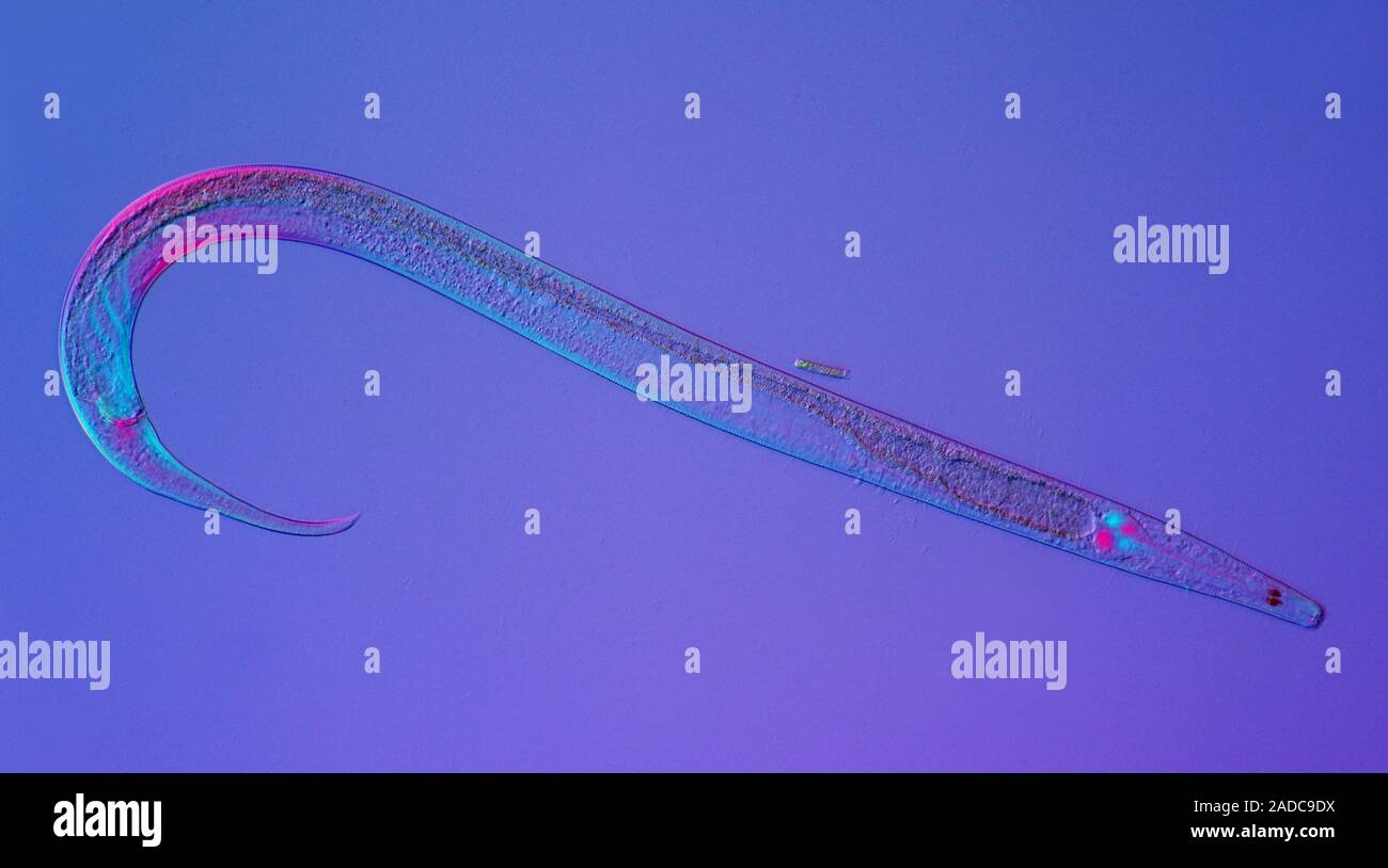 Nematode roundworm. Polarized light micrograph of a nematode (roundworm ...