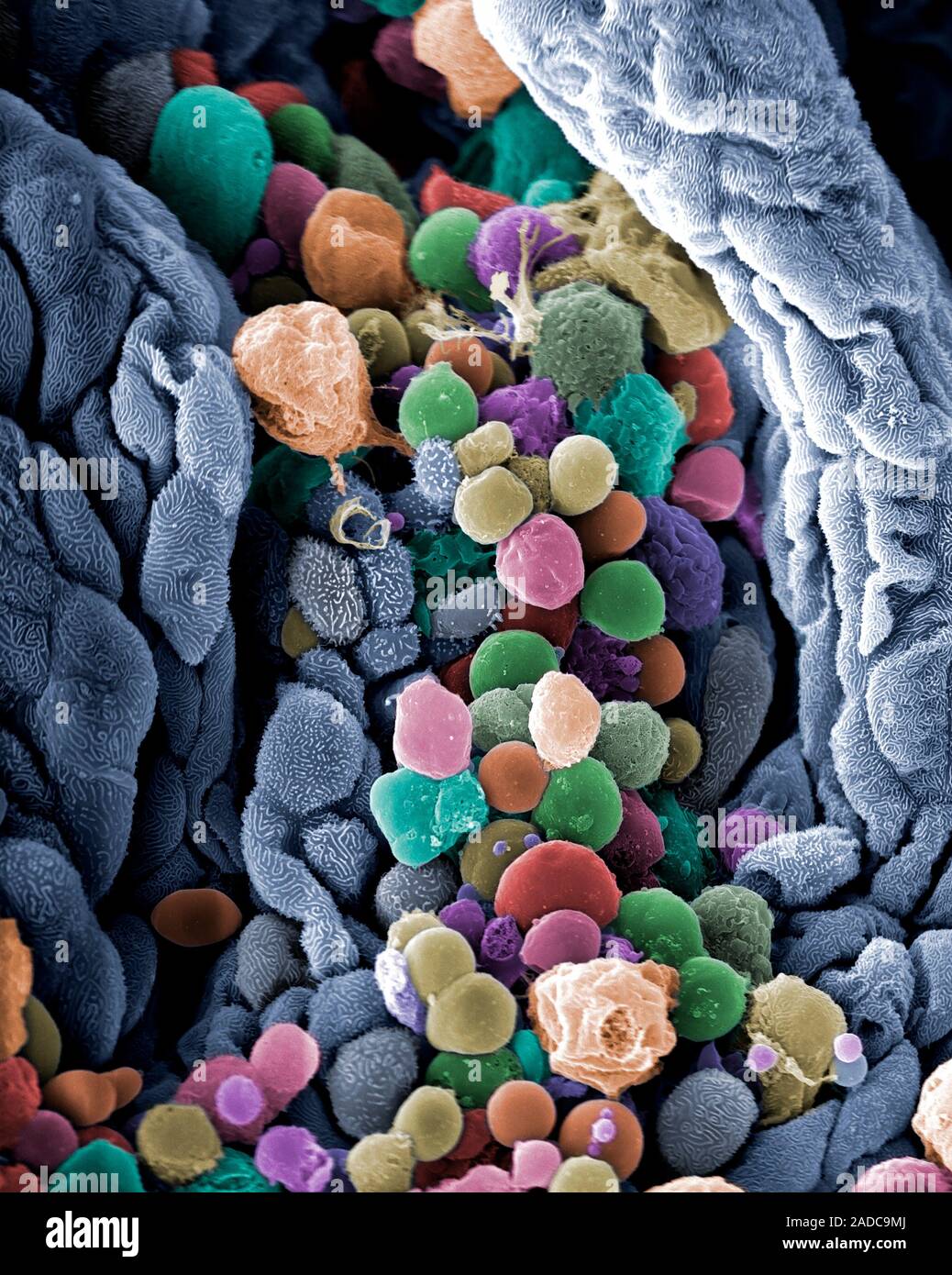 Coloured scanning electron micrograph (SEM) of a salmon gill affected ...