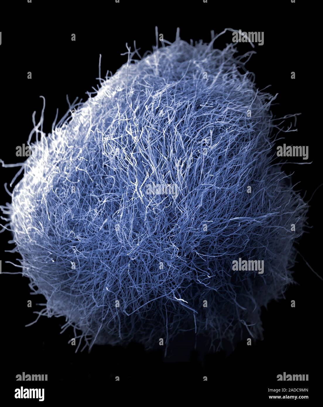 Coloured scanning electron micrograph (SEM) of a Saprolegnia parasitica ...