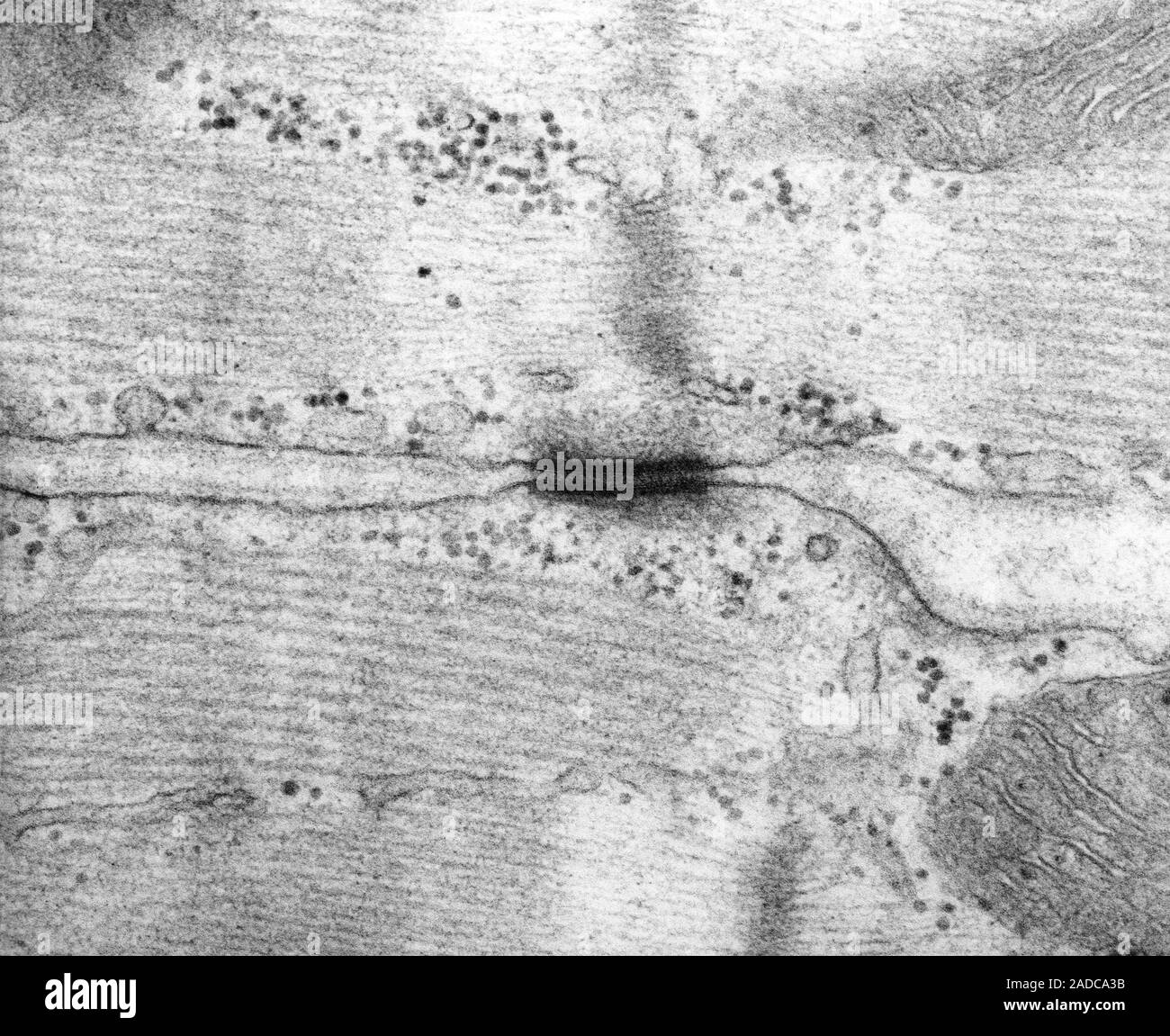 Desmosome (also known as macula adherens) between heart muscle cells ...