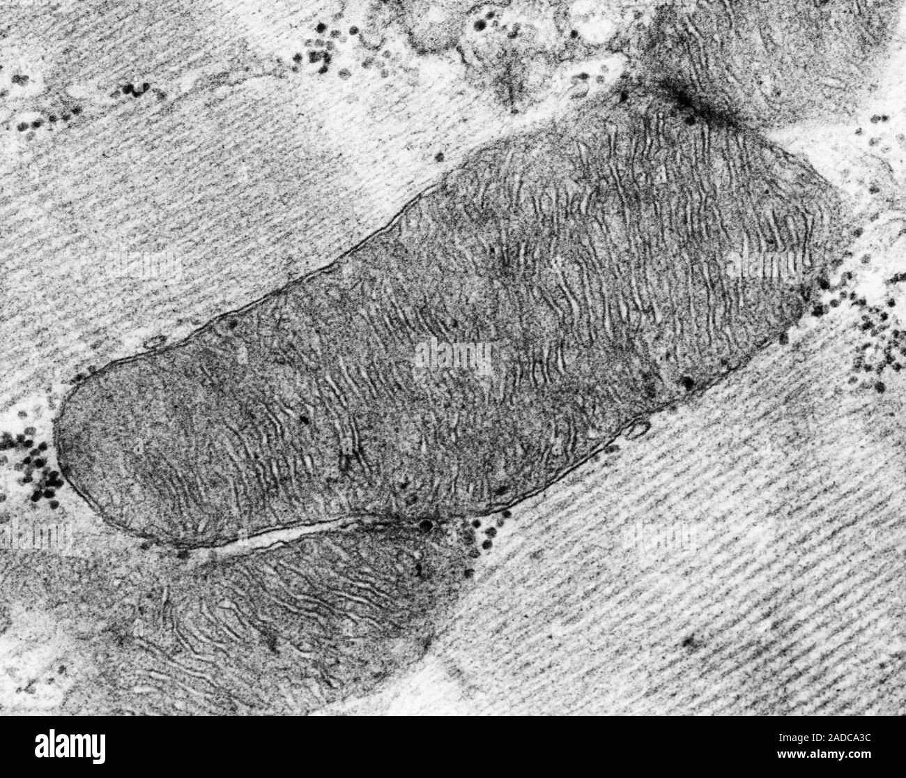 Mitochondrion from a heart muscle cell showing numerous cristae ...