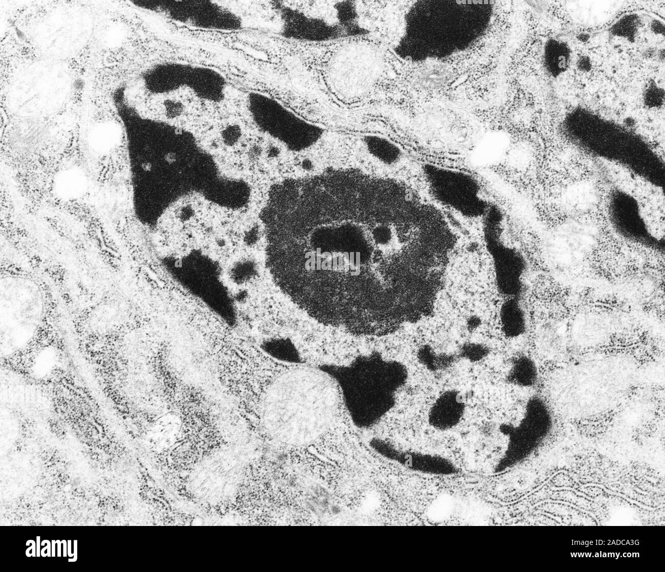 Transmission electron micrograph (TEM) of Nucleus from a neuroglial ...