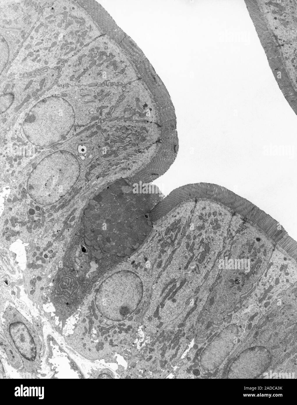 Goblet cell in the mucosal lining of the small intestine (part of the ...