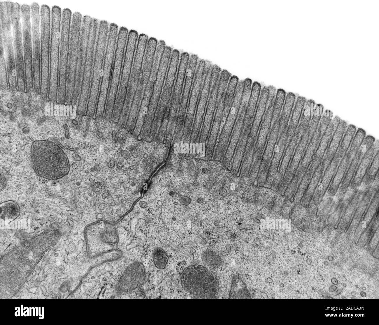 Small intestine villus (human), transmission electron micrograph (TEM ...