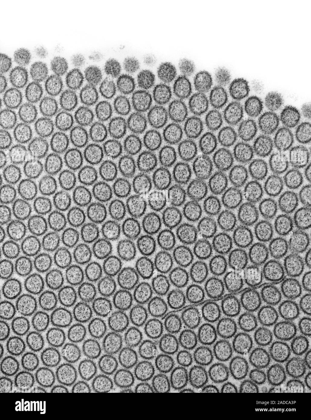 Villus of the small intestine (human), transmission electron micrograph ...