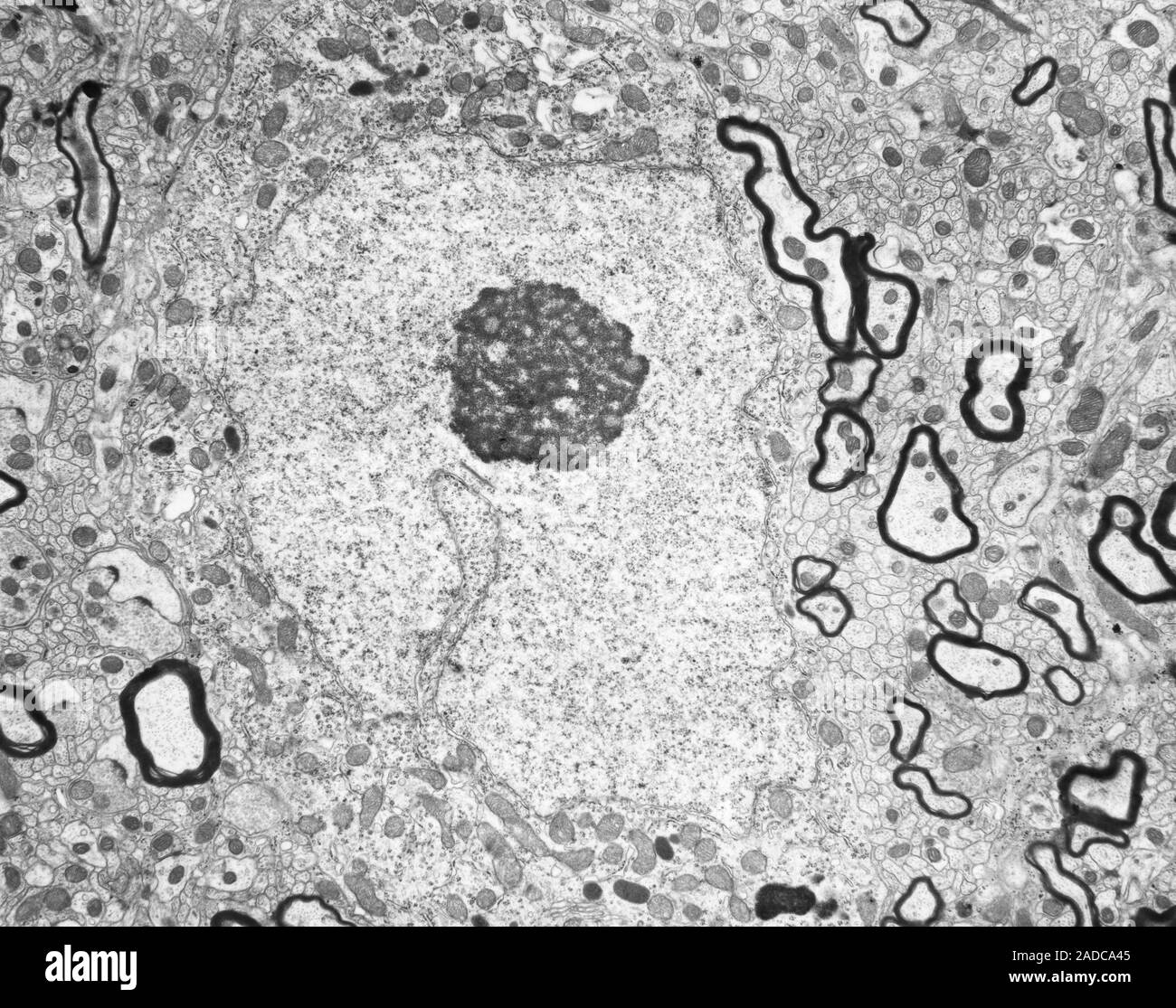 Neuron cell body with large nucleus and nucleolus (central nervous ...