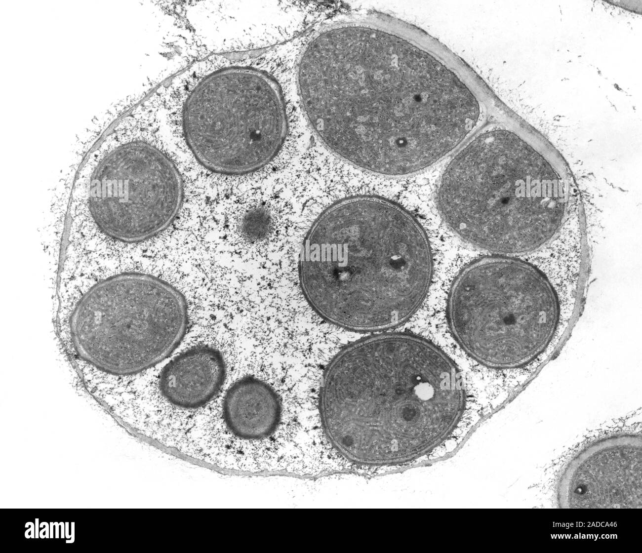 Transmission electron micrograph (TEM) of Cyanobacteria endospores ...