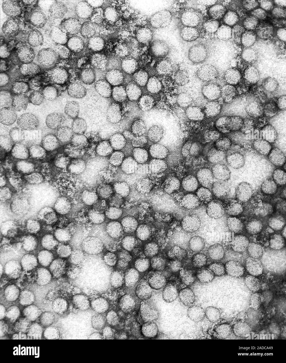 Yellow fever virus particles (virions), transmission electron ...