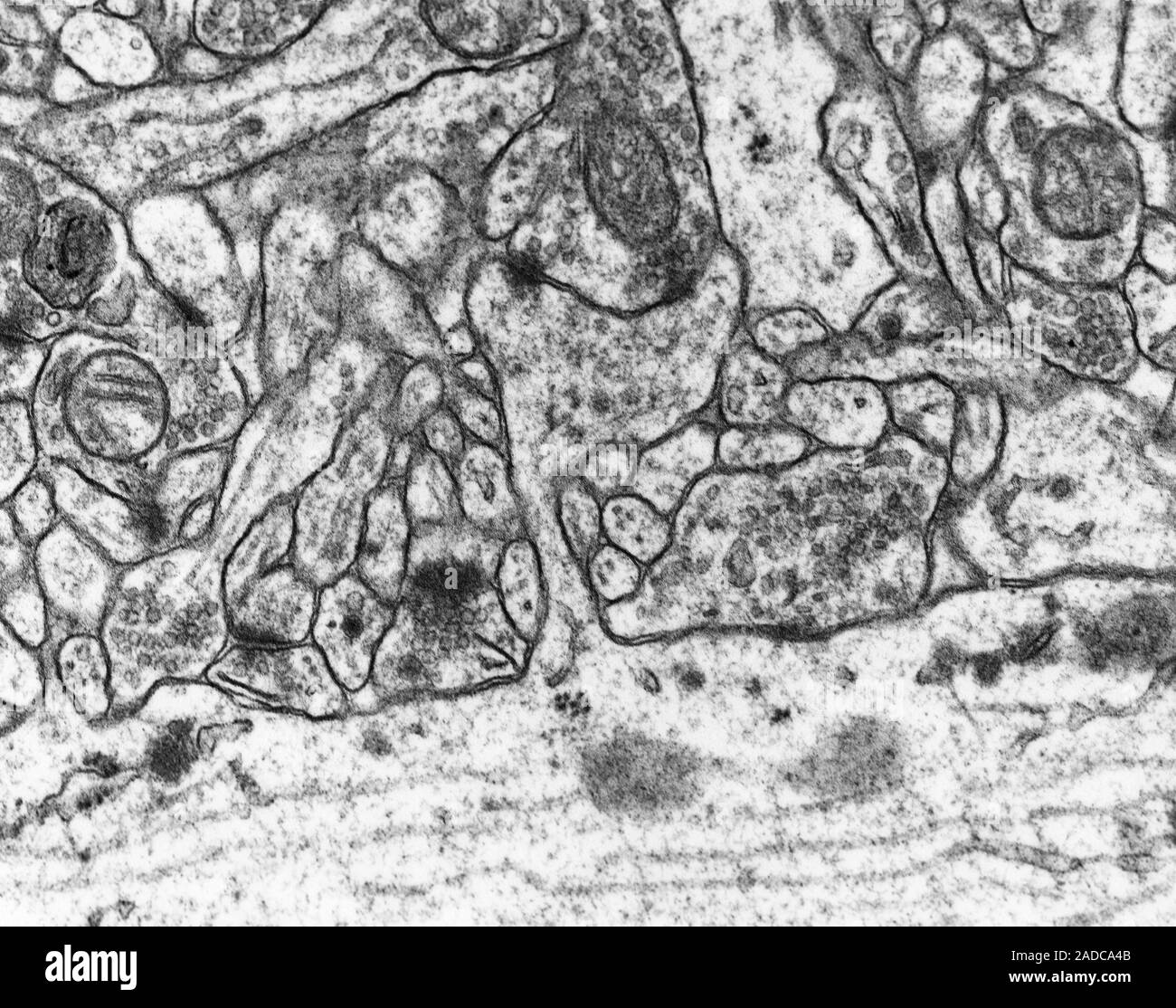 Neuron dendritic spine with excitatory synapse, transmission electron ...