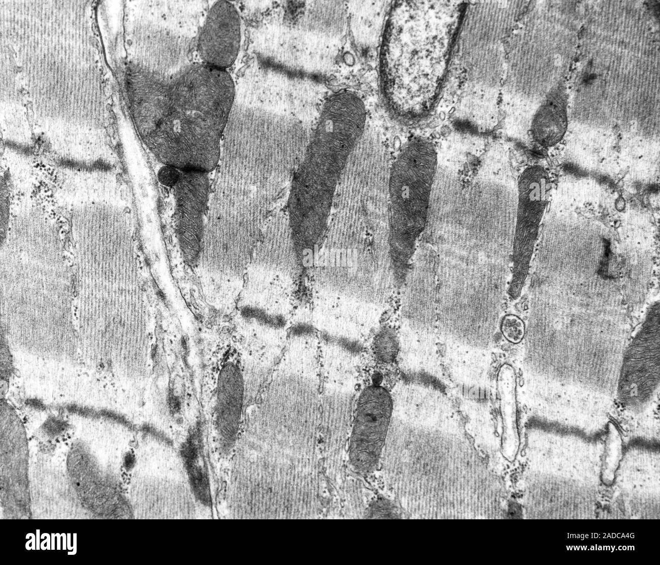 Heart muscle cell (human); nucleus, mitochondria, actin and myosin ...