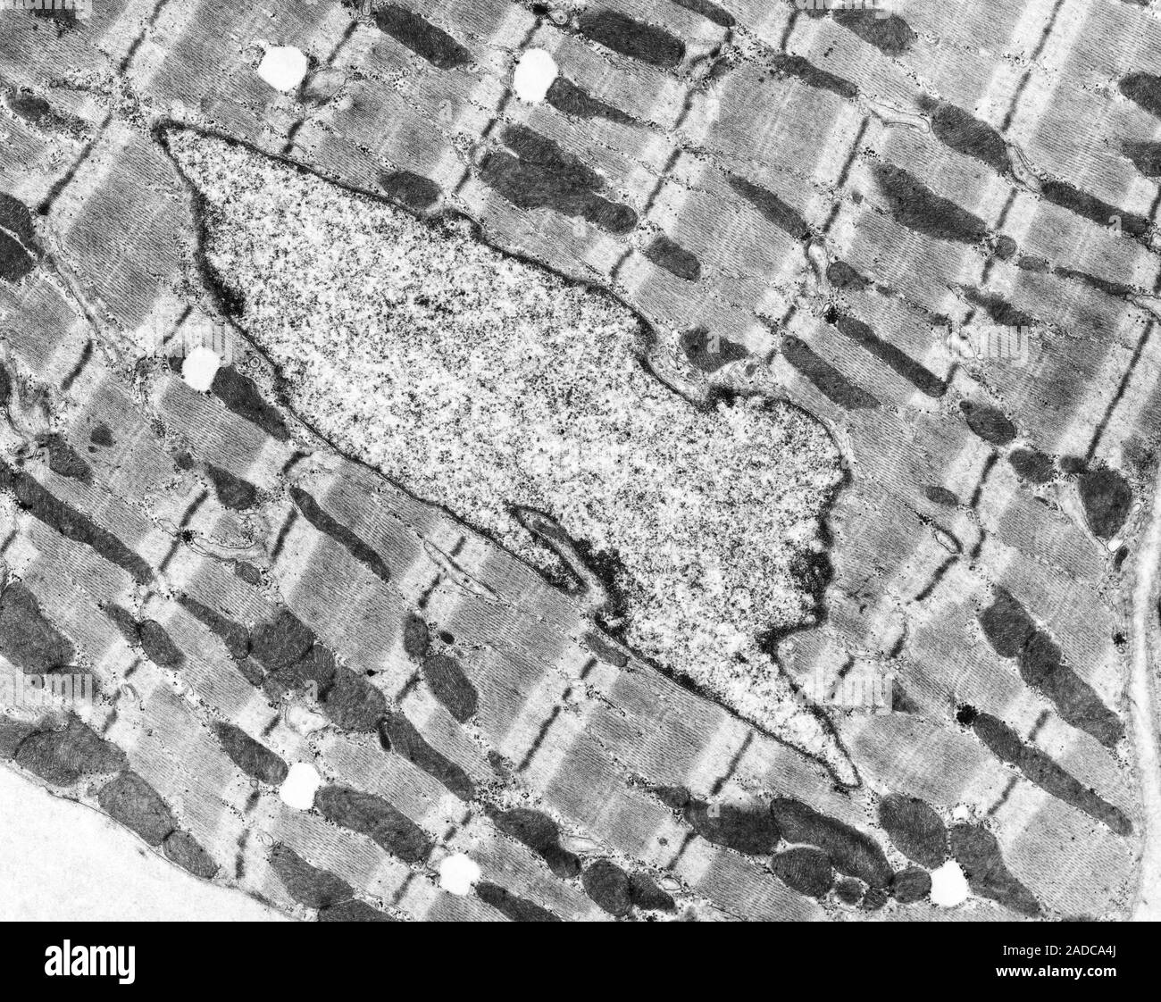 Heart muscle cell (human); nucleus, mitochondria, actin and myosin ...