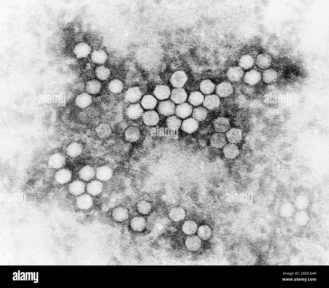 Polio virus, cause of poliomyelitis, RNA virus (Enterovirus C ...