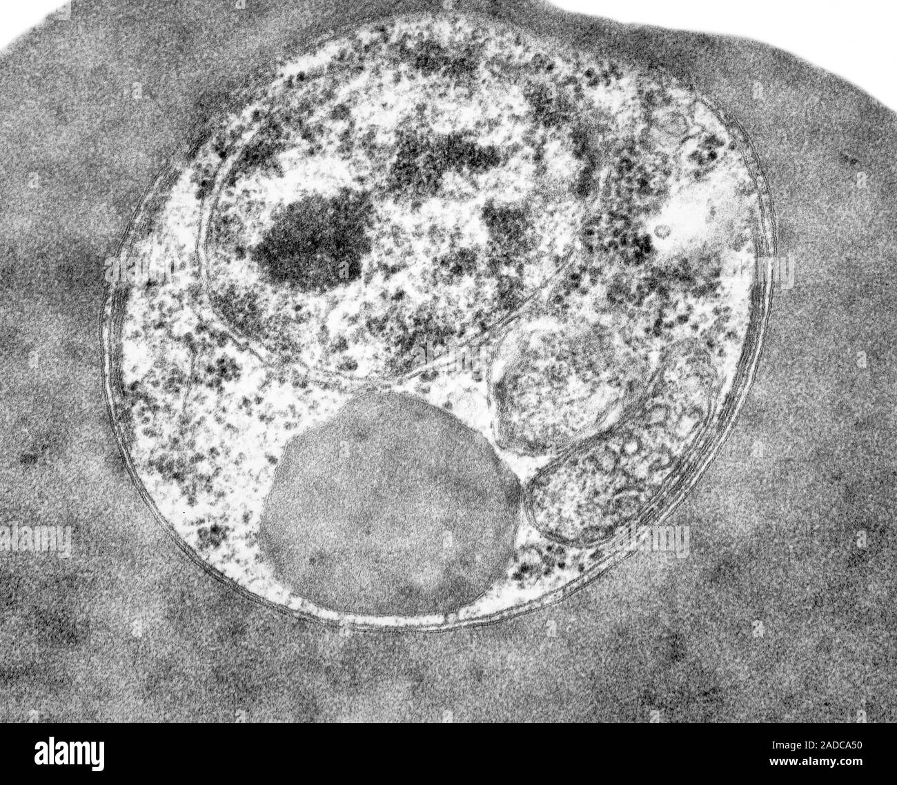 Plasmodium falciparum plasmodial trophozoite (young trophozoite stage ...
