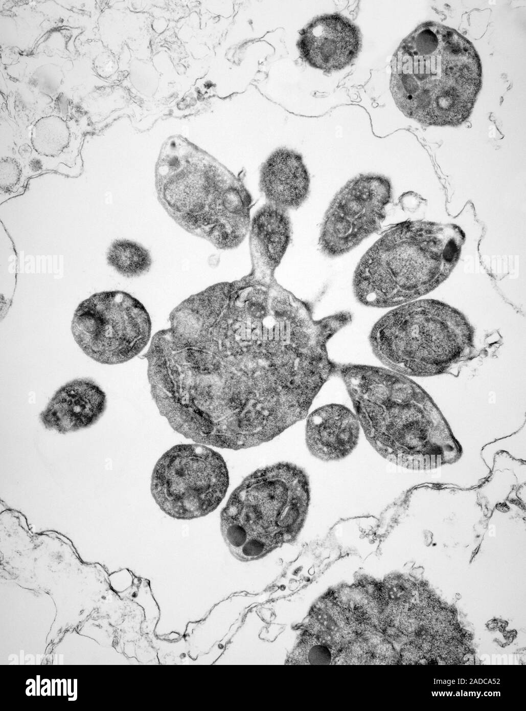Plasmodium falciparum plasmodial schizont, or segmenter, in an ...