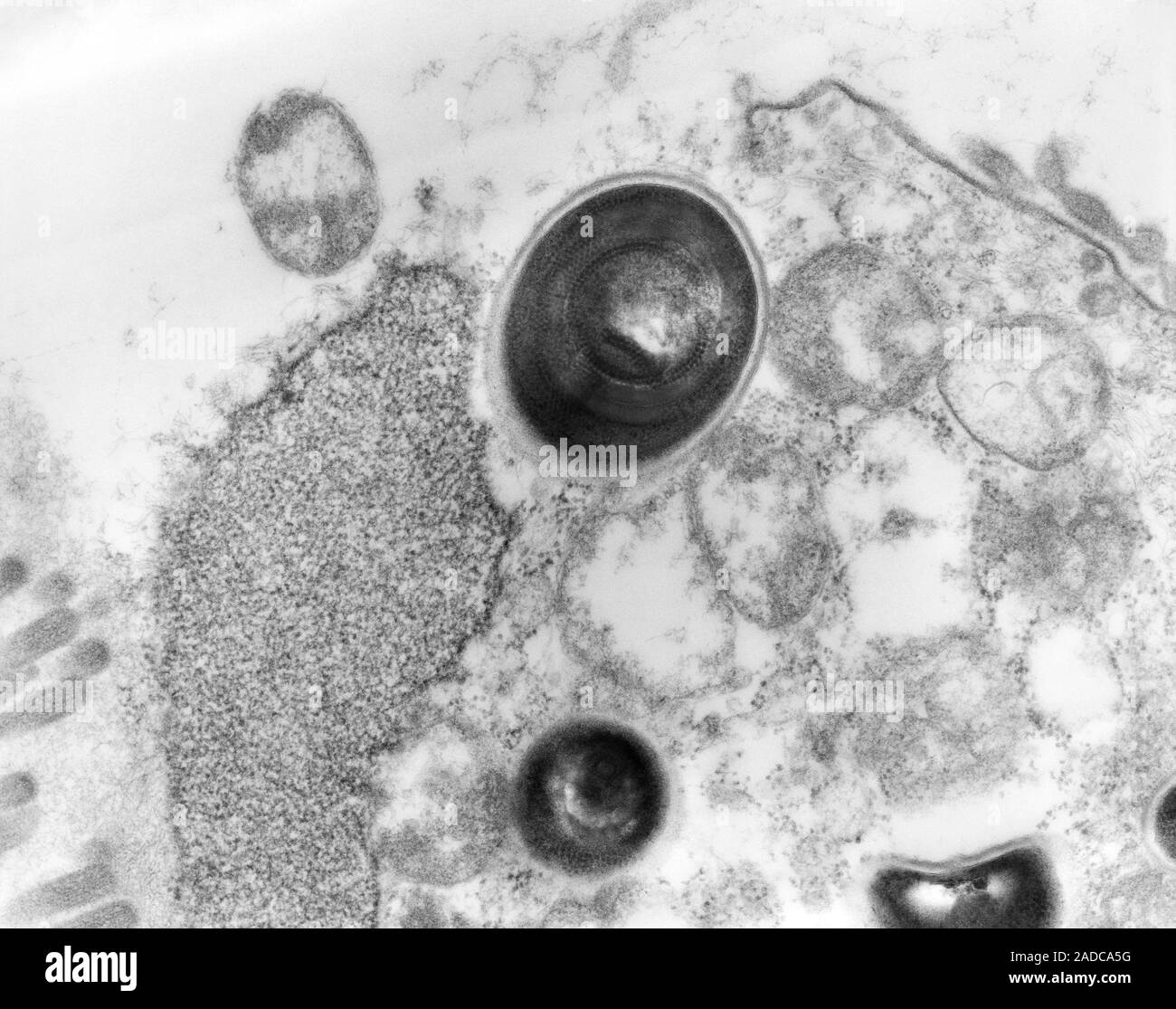 Transmission electron micrograph (TEM) of Enterocytozoon bieneusi ...