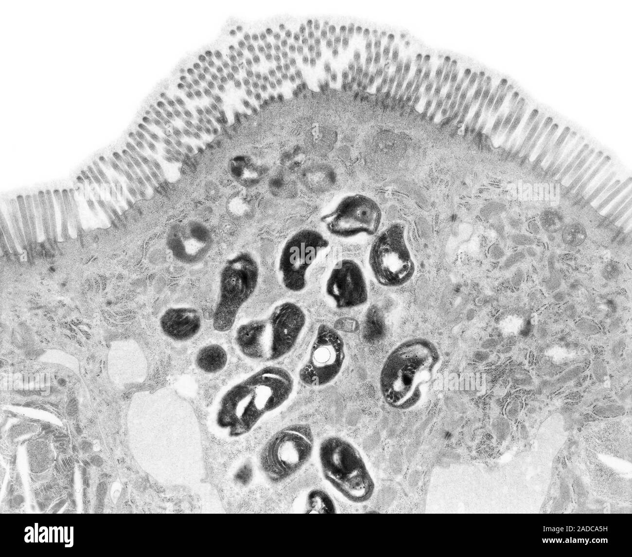 Transmission electron micrograph (TEM) of Enterocytozoon bieneusi ...