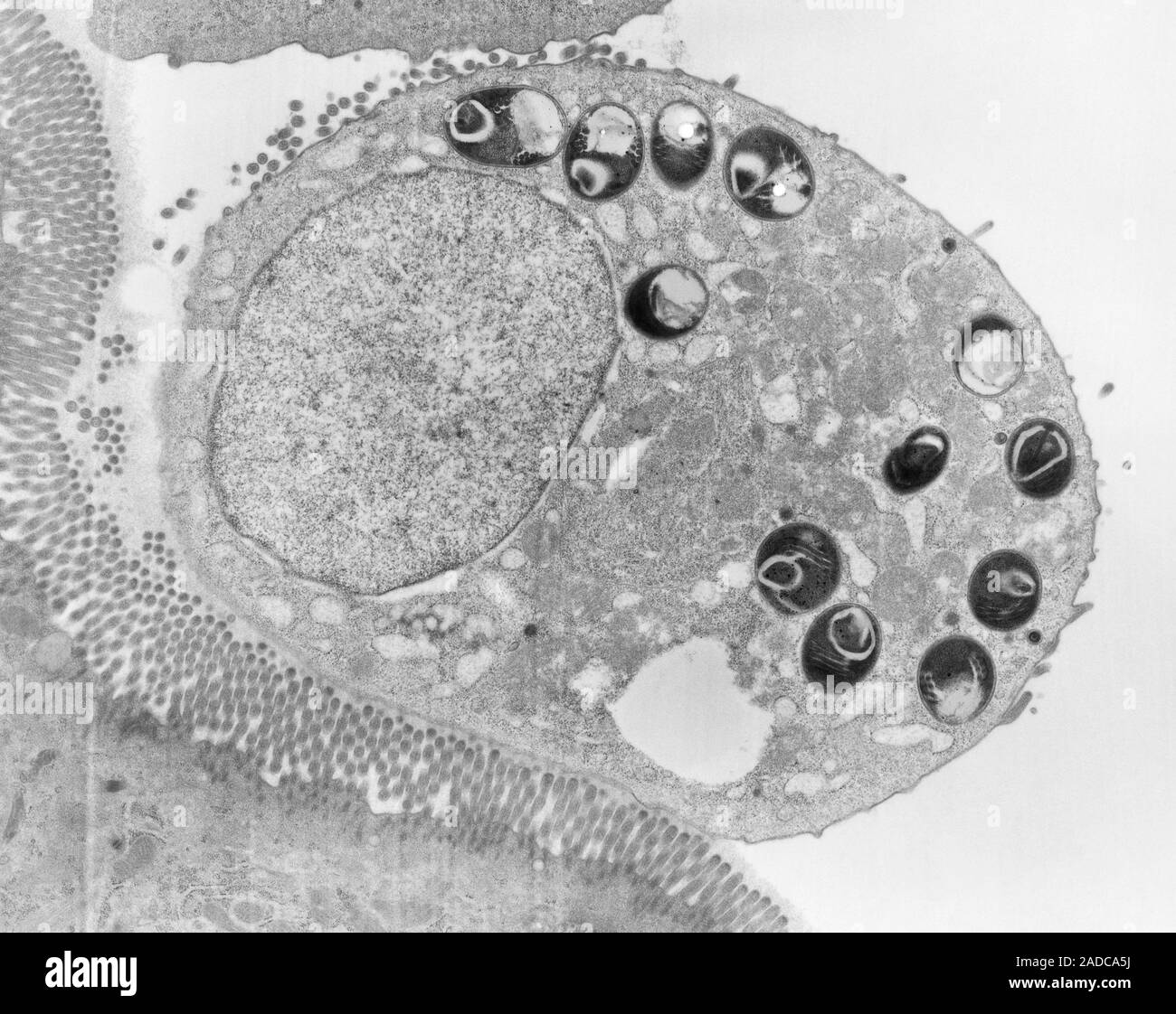 Transmission electron micrograph (TEM) of Enterocytozoon bieneusi ...