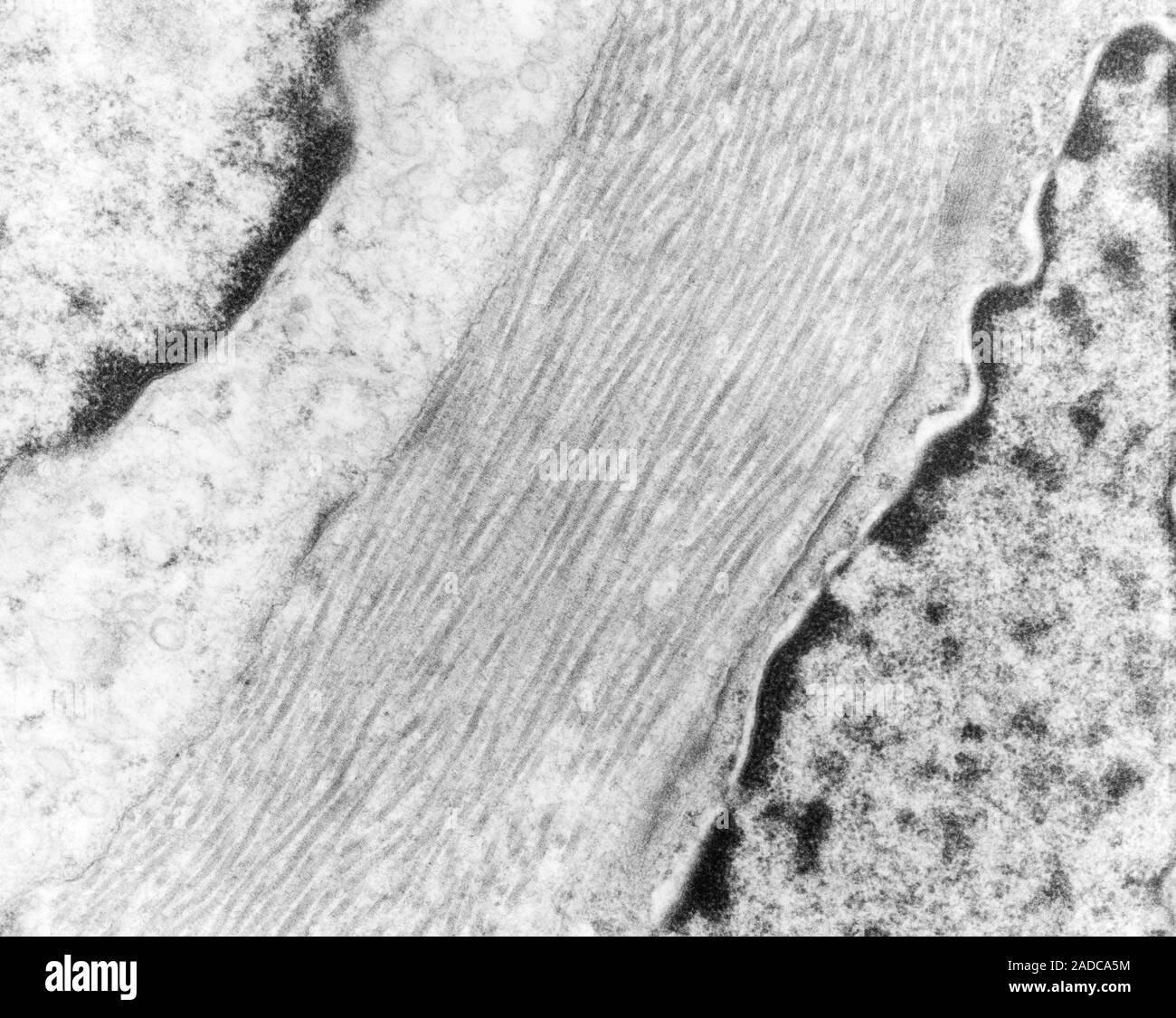 Collagen fibres (connective tissue) between human skin epithelial cells ...