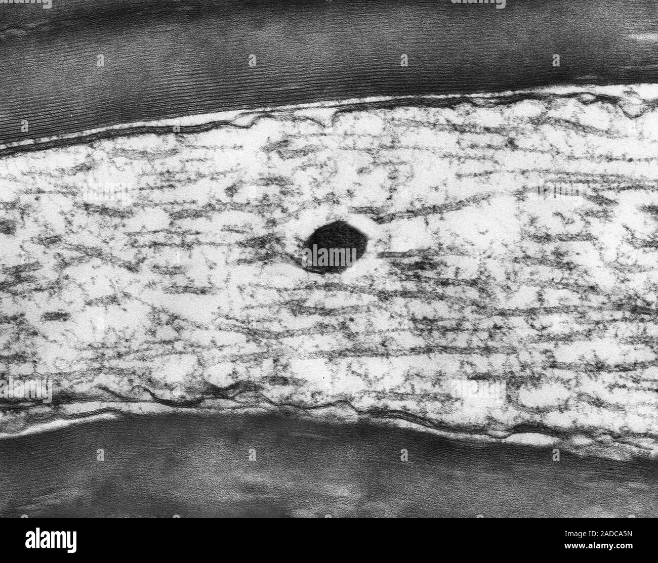 Myelinated axon from a central nervous system neuron (mammal ...