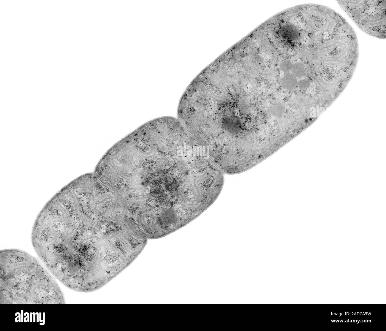 Transmission electron micrograph (TEM) of Cyanobacterium (Nostoc sp ...