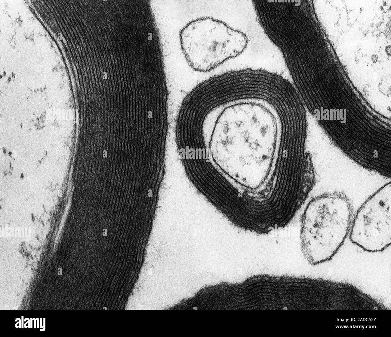 Cross Section Of Myelin Sheaths That Surround Axons Central Nervous System Transmission