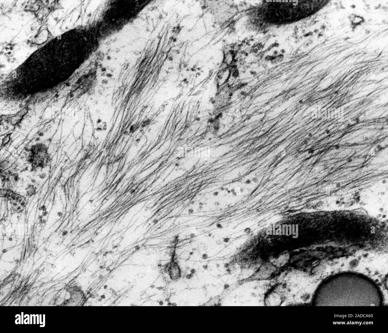 Neurofilaments in a neuroglial cell - astrocyte (mammal central nervous ...